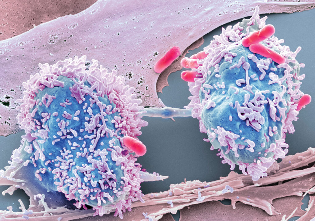 Chemical Strategies and Solutions for Bacteria and Cancer cell ...